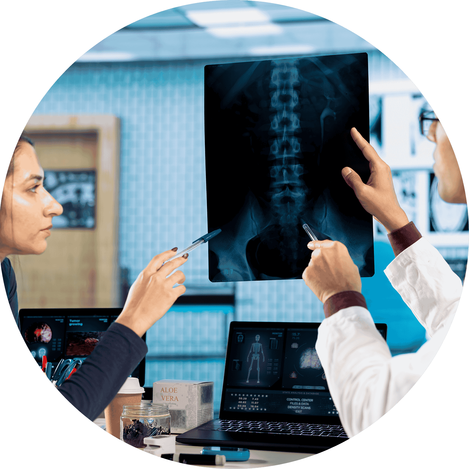 Bone Densitometry – Pioneer Diagnostic and Imaging